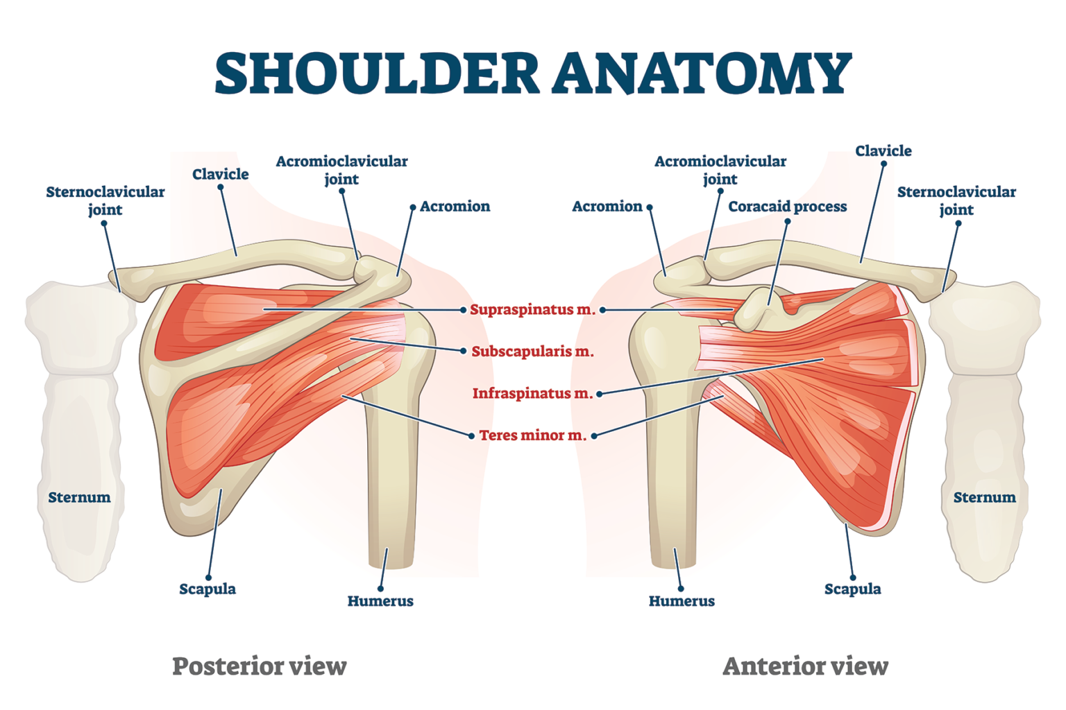 Acromioclavicular Joint Arthritis of the Shoulder - Idaho Shoulder to Hand